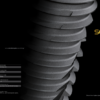 Dental Implant - Dentis USA